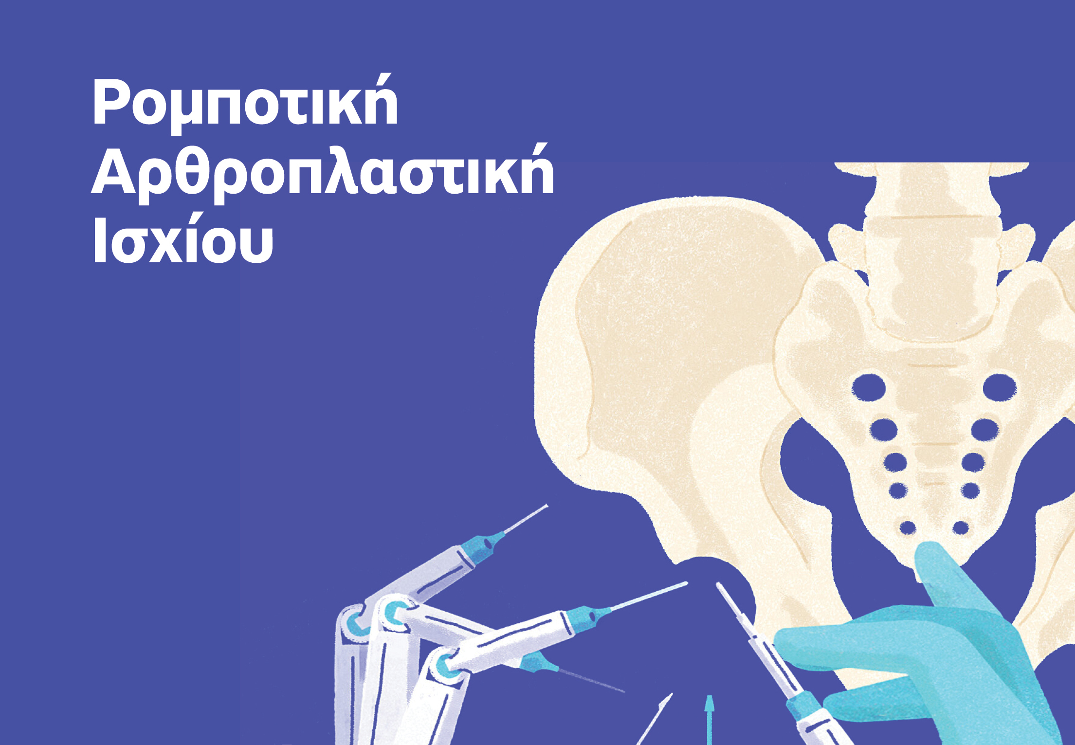 Ρομποτική Αρθροπλαστική Ισχίου: Γιατί πλεονεκτεί; - Κουρδιστό Πορτοκάλι